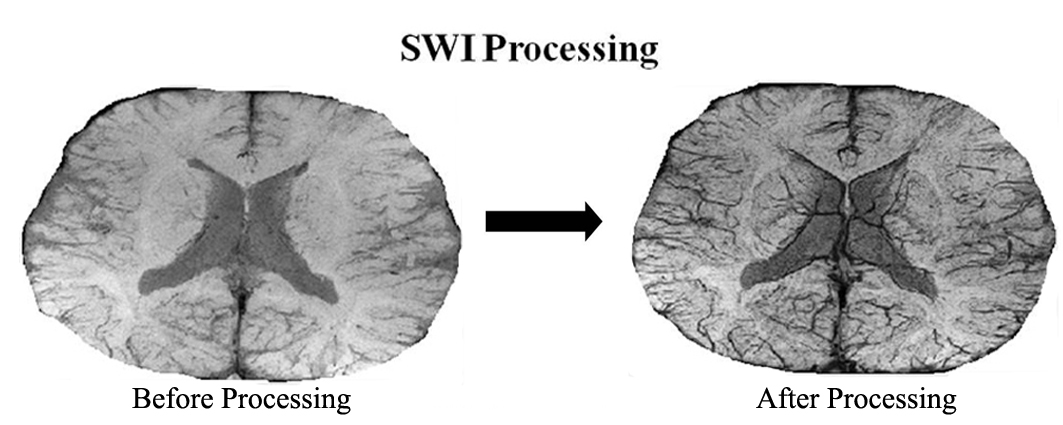 Unleashing the Power of Generative AI in Medical Imaging - StatusNeo